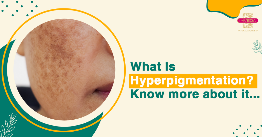 Know how to get rid of hyperpigmentation with easy tips and hacks