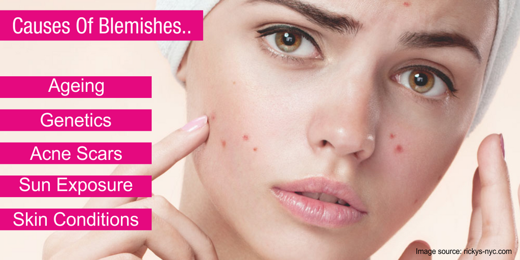 GET TO KNOW ABOUT STUBBORN BLEMISHES - Inveda