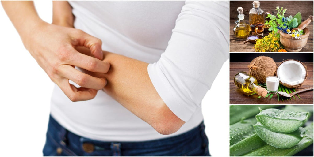 HOME REMEDIES TO GET RID OF ITCHY SKIN - Inveda