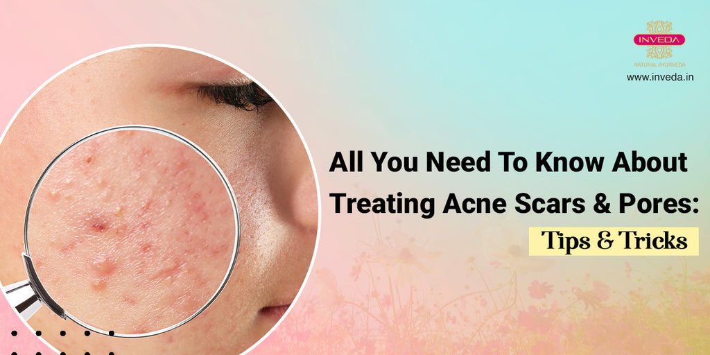 All You Need To Know About Treating Acne Scars And Pores