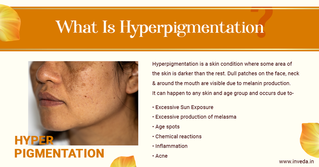 7 Best Ingredients For Hyperpigmentation With 2021 Regimen Calendar ...
